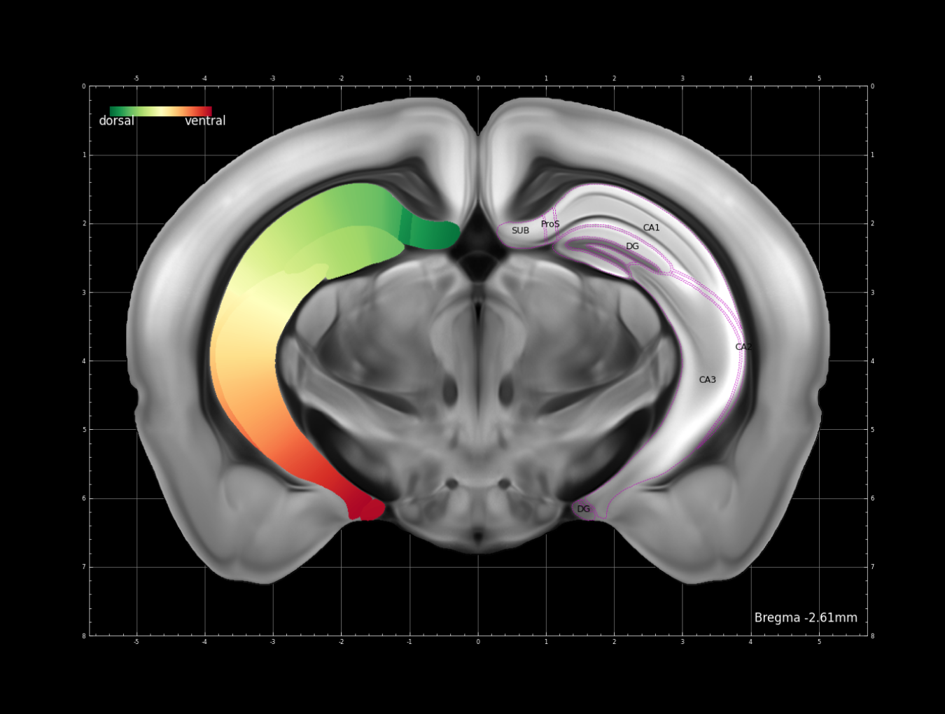 Digital Brain CEBSIT(ION)
