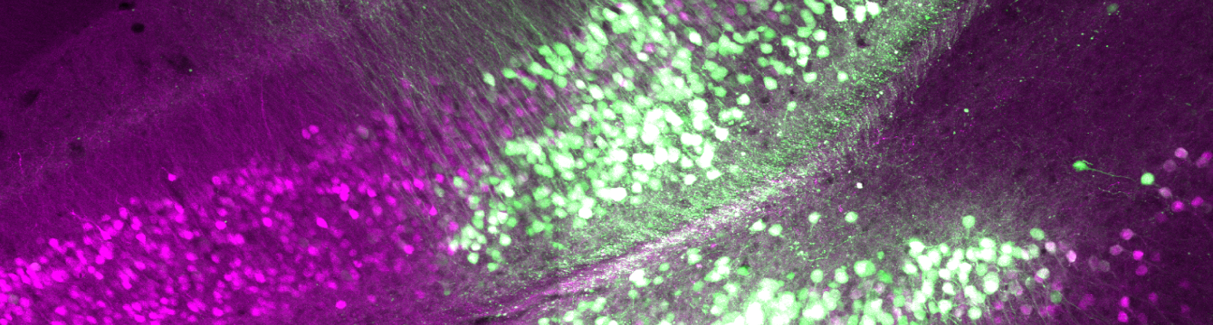 Digital Brain CEBSIT(ION)