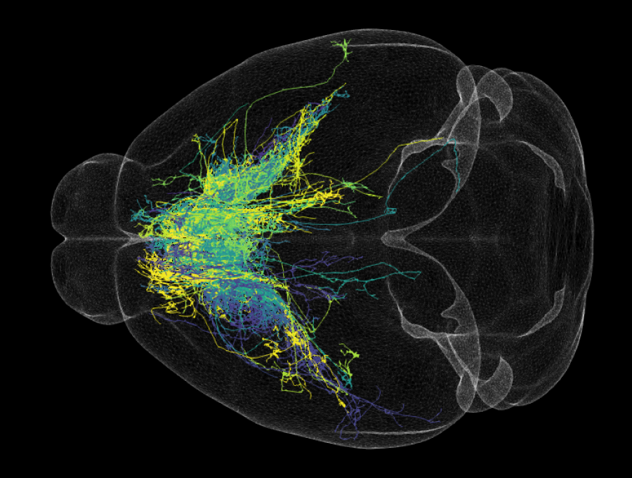 Digital Brain CEBSIT(ION)
