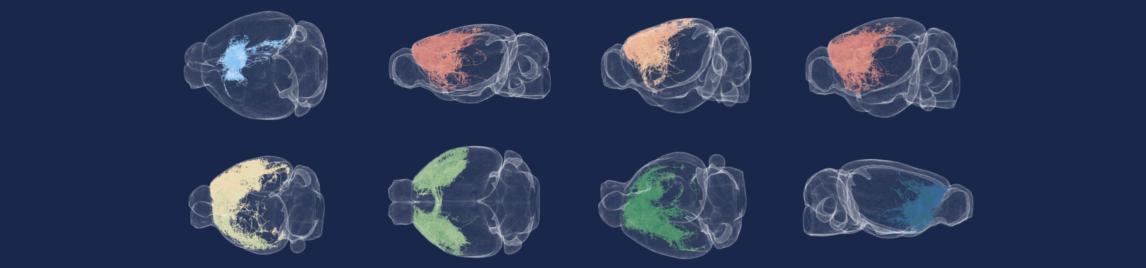 Digital Brain CEBSIT(ION)
